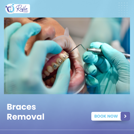 Schedule Appointment with Ruflo Dental Clinic