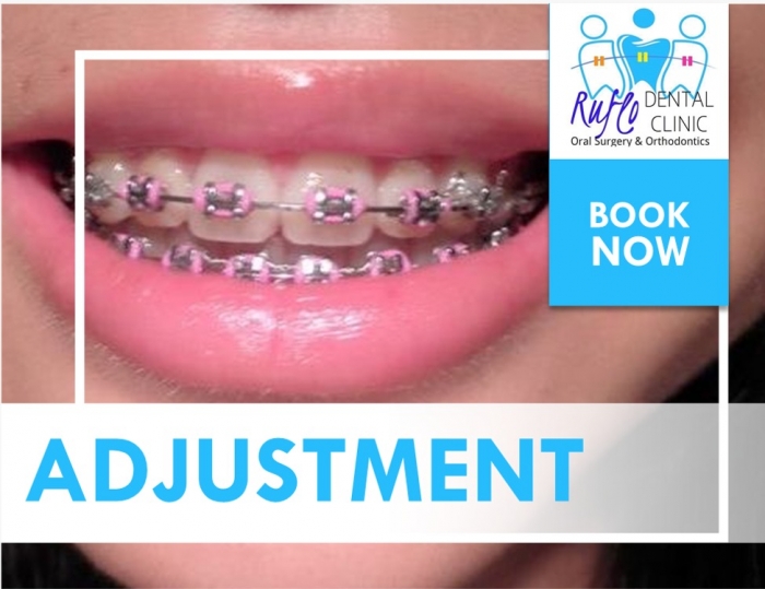 Schedule Appointment with Ruflo Dental Clinic