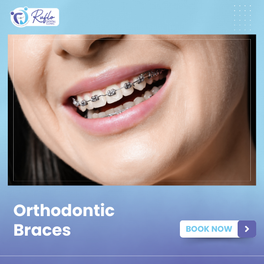 Schedule Appointment with Ruflo Dental Clinic