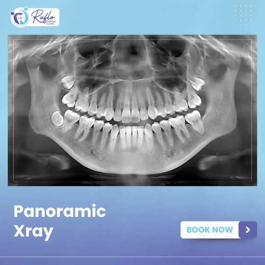 Schedule Appointment with Ruflo Dental Clinic